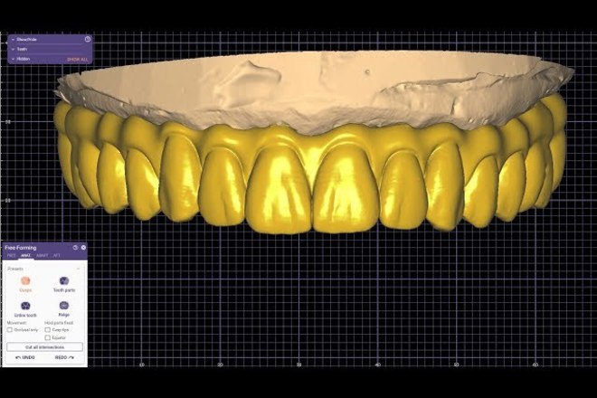 Dental Exocad designer - CadCam Masters