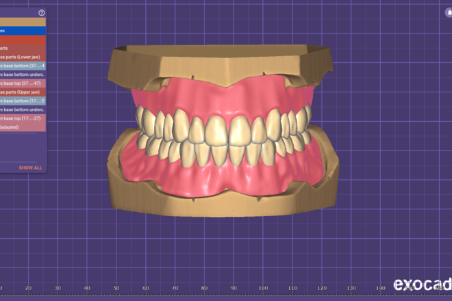 complete denture - CadCam Masters