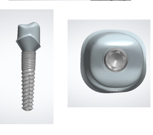 Custom titanium abutment - CadCam Masters