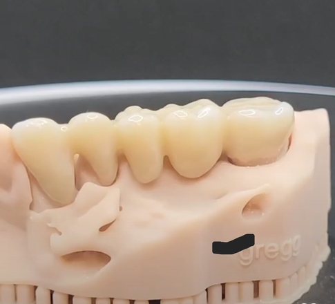 Anatomic crown and bridges - CadCam Masters