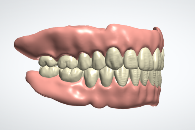 complete denture design - CadCam Masters