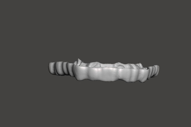 bite splint/night guard/ ferulla - CadCam Masters