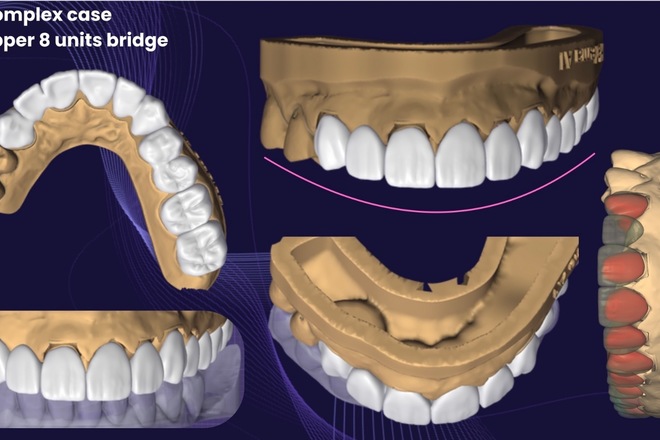 Aesthetic bridges - CadCam Masters
