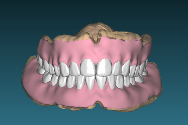 Full Denture Design Fr - CadCam Masters