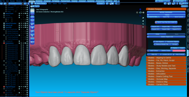 Crown & Bridge - Precise, Anatomical, Ready for Production - CadCam Masters