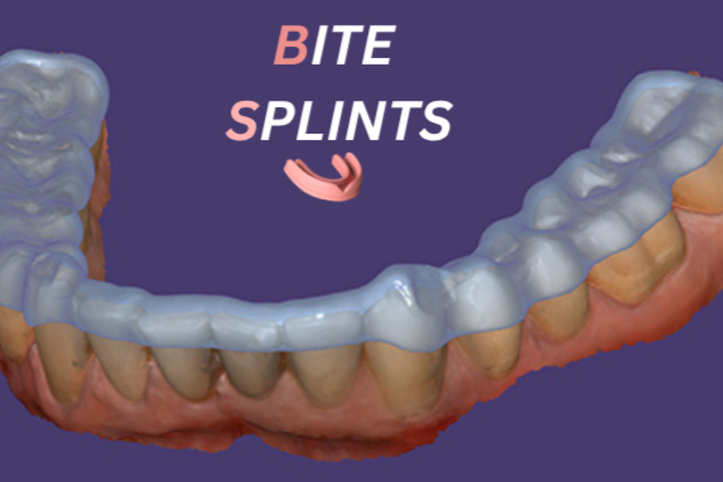 Bite Splints - CadCam Masters