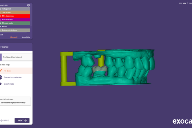 Premium inlays/ onlays - CadCam Masters