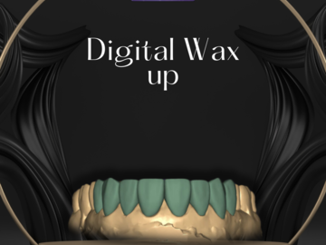 Digital Wax Up - CadCam Masters