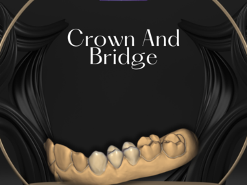 Crown & Bridge Design - CadCam Masters