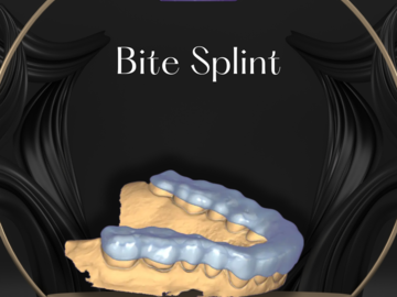 Bite Splint - CadCam Masters