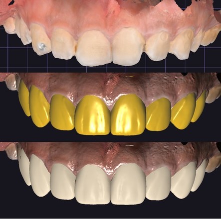 Dental Designer - CadCam Masters