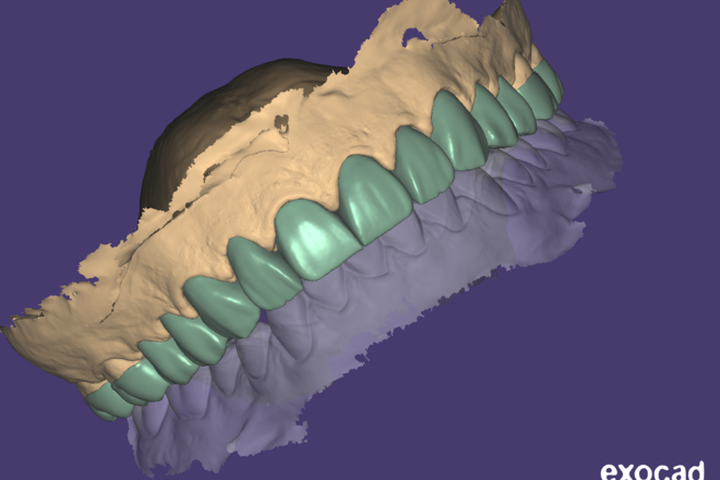 full arch - CadCam Masters