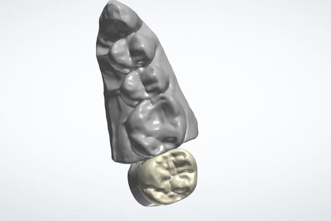 Full anatomic Crown/Bridge Designs - Unlimited Revisions - CadCam Masters