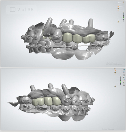 Dental CAD CAM designer - CadCam Masters