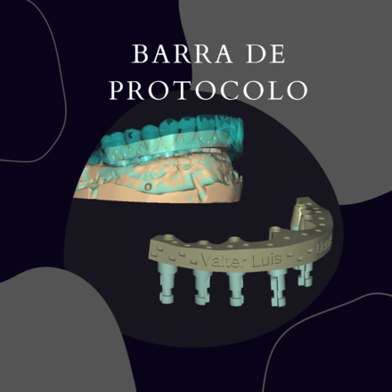 Barra Protocolo personalizada - CadCam Masters