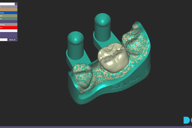 Crown & Bridge & Inlay / Onlay + MODEL - CadCam Masters