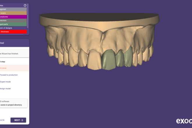 CROWN AND BRIDGE DESIGN - CadCam Masters