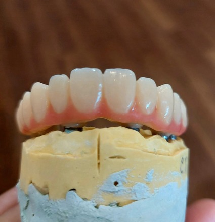 Full Arch - CadCam Masters