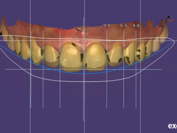 CadCam Masters - Freelancer Cad Designer | Hire Dental Cad Designer
