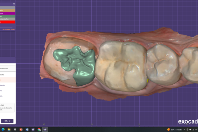 Dental CAD/CAM designer - CadCam Masters