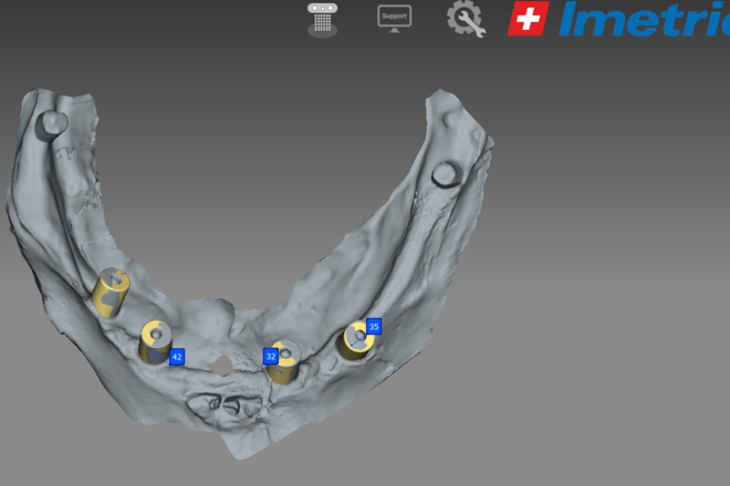 Full arch implant structures using iCAM Data - CadCam Masters