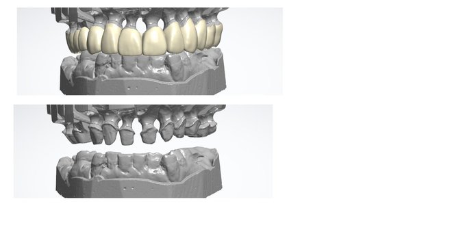 Crown & Bridge Cad Design with Model Design Fee - CadCam Masters