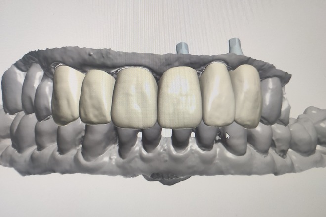 Dental cad designer - CadCam Masters