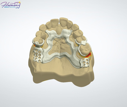 RPD Design Specialist - CadCam Masters