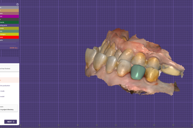 Implant prosthetics - CadCam Masters