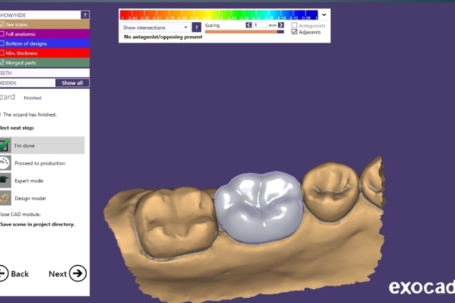 Provisional crown&bridge - CadCam Masters