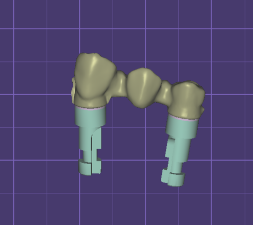crown e bridge metal ceramic - CadCam Masters