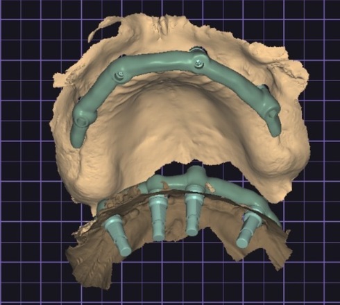 Protocol Bar - CadCam Masters