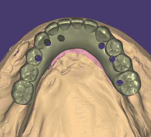 Provide top-notch cad services. : ALL on X - CadCam Masters
