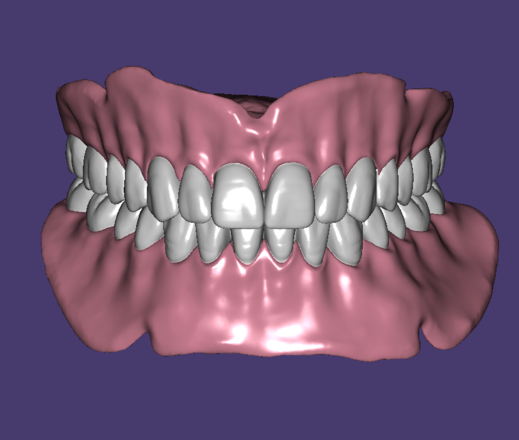 Provide top-notch cad services. : Full denture - CadCam Masters