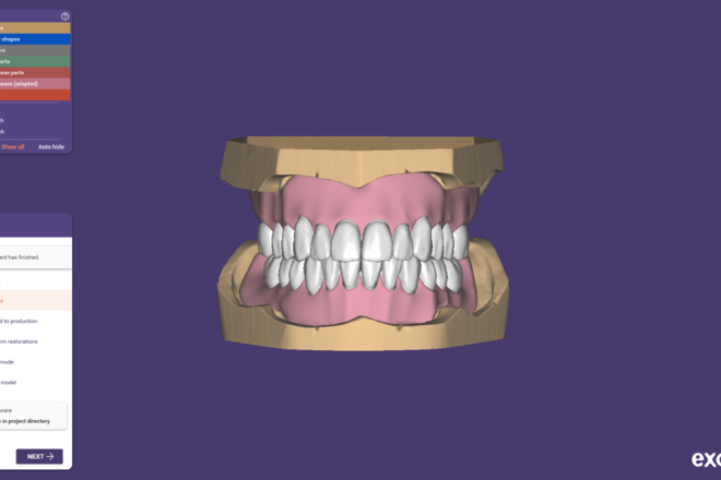 full arch implant - CadCam Masters