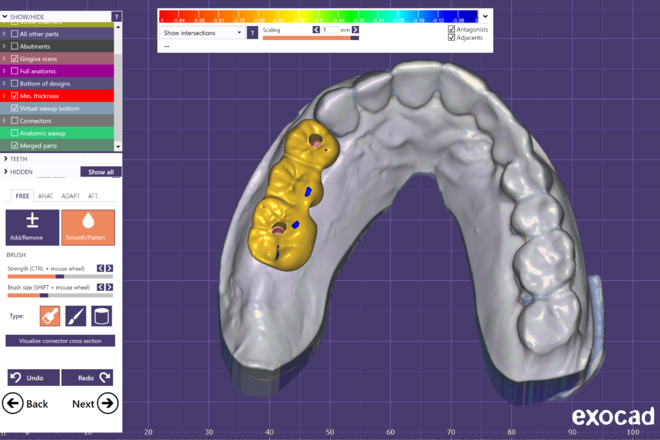 crown&bridges - CadCam Masters