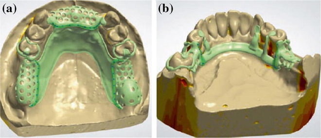 partial denture framework - CadCam Masters