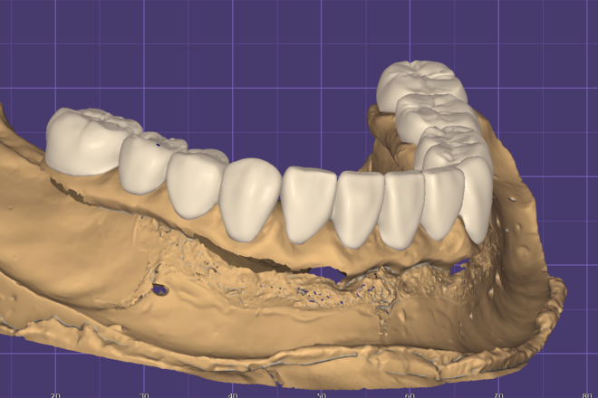 provisionales - CadCam Masters