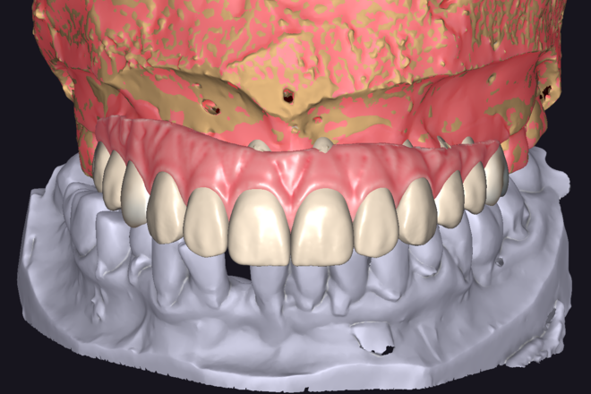 Excellence in Digital Dental Design - CadCam Masters