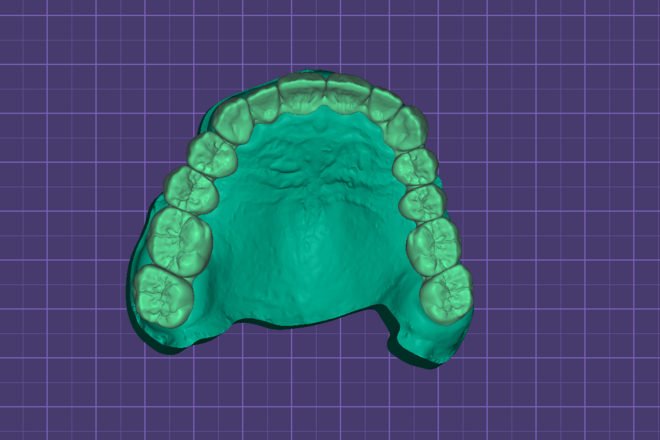 Digital Wax up All on X - CadCam Masters