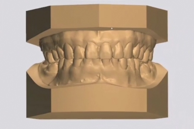 Ortho Model - CadCam Masters