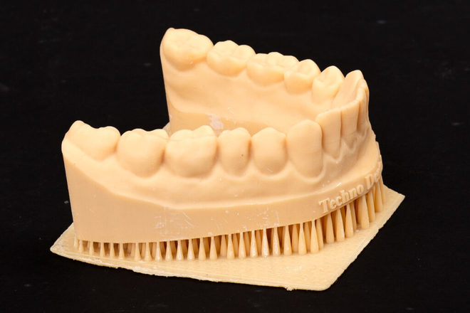 3D Printed Dental Cast Model - CadCam Masters