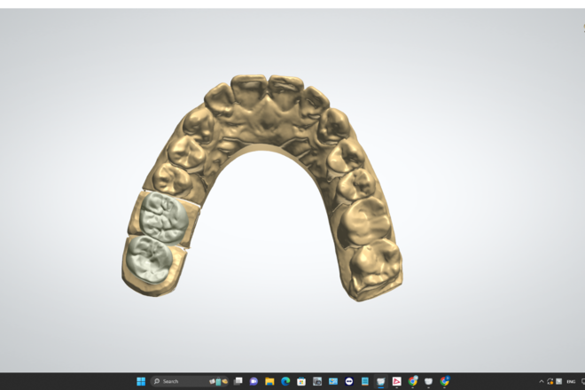Individual Crown Designing and Bridge Designing - CadCam Masters